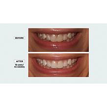 Teeth Whitening Kits | HSN